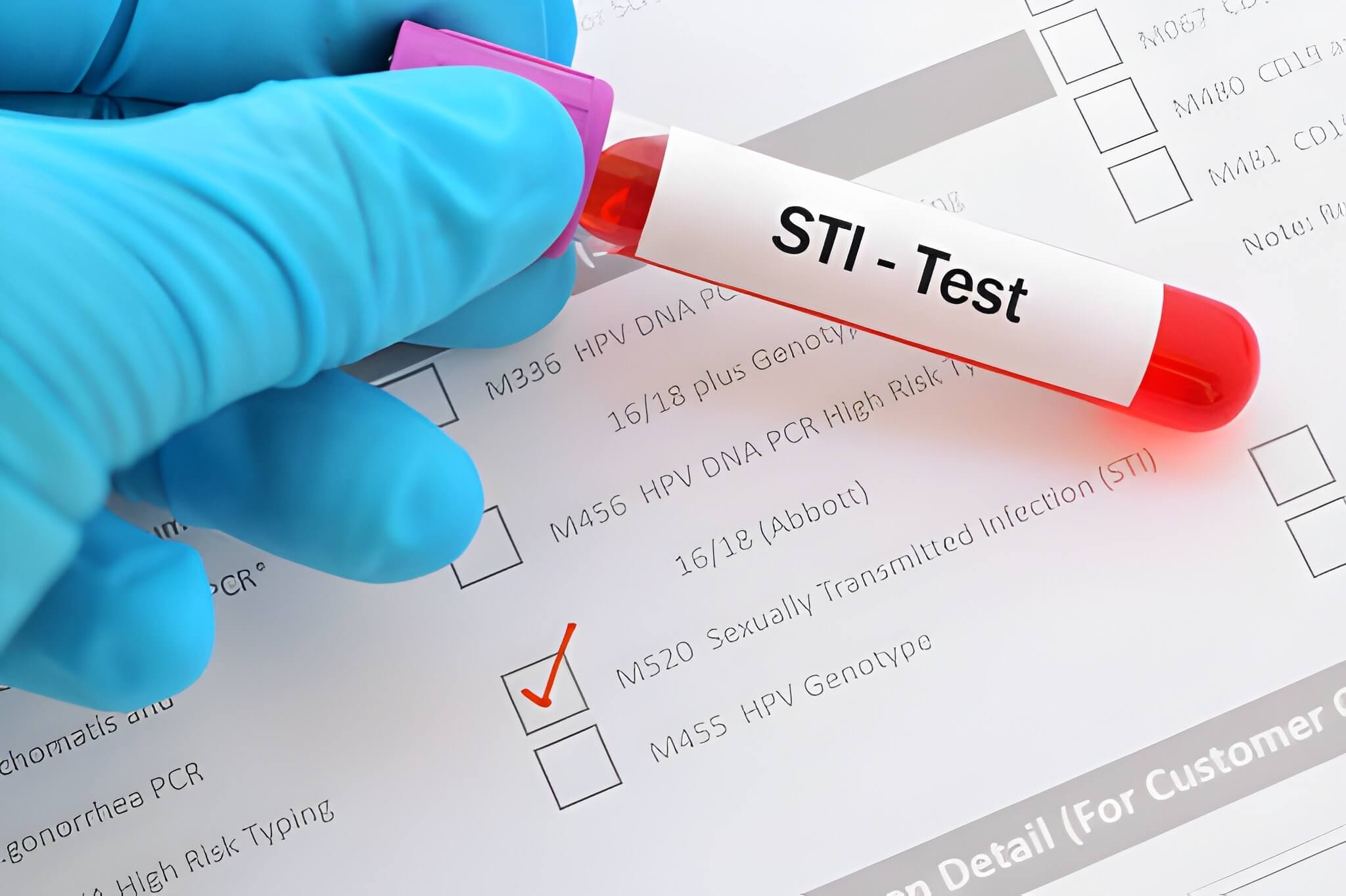 First Lady STI: Symptoms, Signs & Treatment Guide